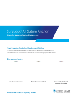 SureLock® All-Suture Anchor